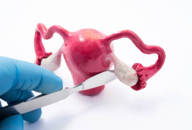 Ovarian Cysts - Veritas OBGYN